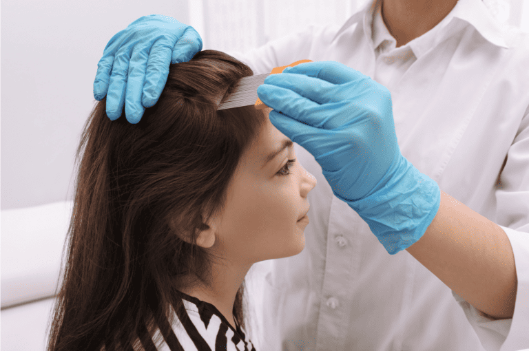 Can Head Lice Jump? Separating Myths from Facts and Gaining Clear ...