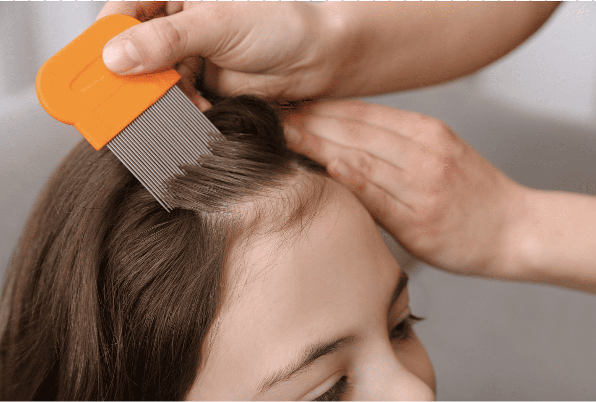 Is Spotting Lice Harder Based on Hair Color? - Lice Free Clinics