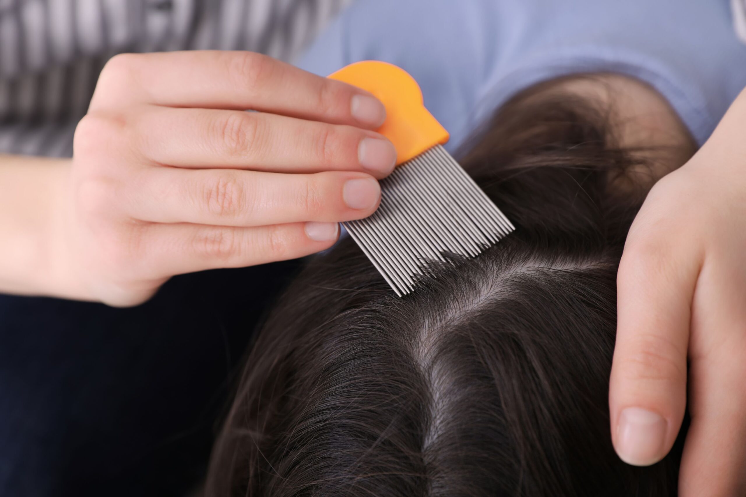 Super Lice: What They Are and How to Get Rid of Them for Good - Lice ...